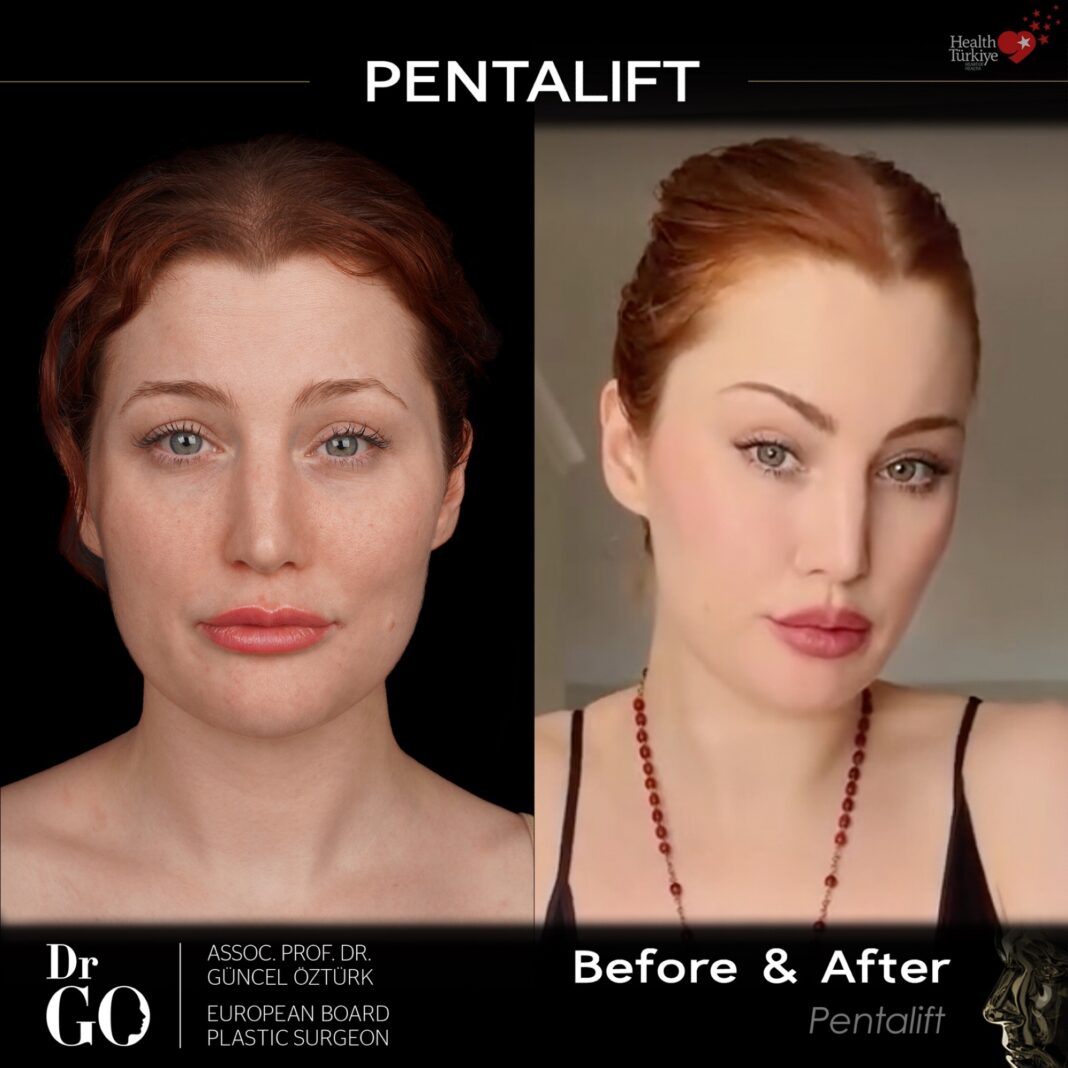 Top 10 Best Plastic Surgeons in Turkey: 2026 Istanbul Insider List ...